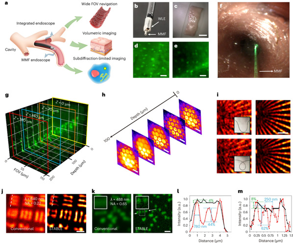 STABLE endoscopy: Achieving super-resolution imaging using multimode ...