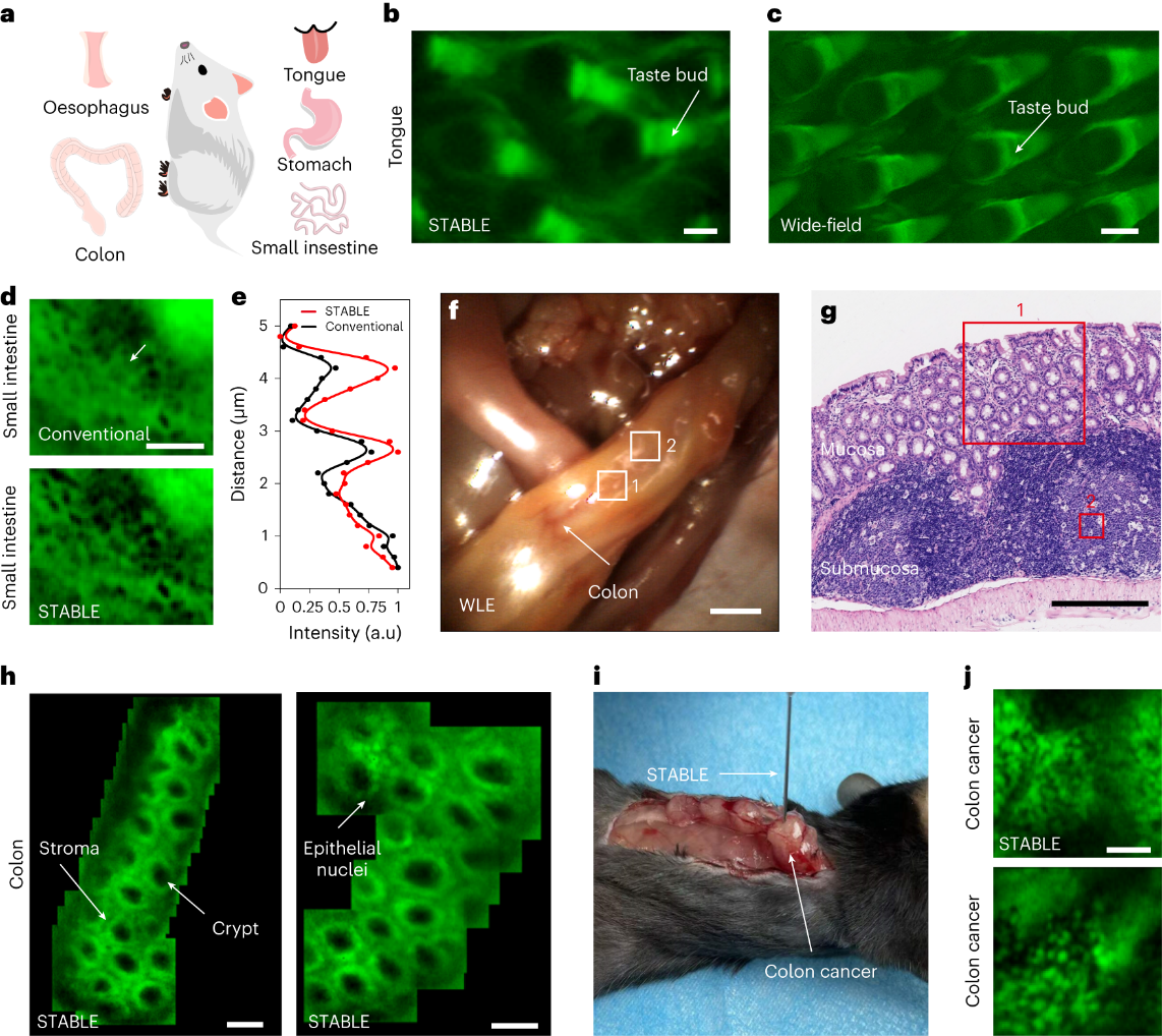 STABLE endoscopy: Achieving super-resolution imaging using multimode ...