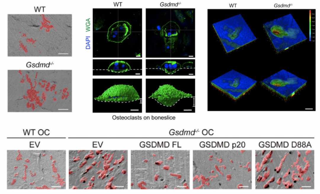 基础医学院王迪课题组《Developmental Cell》揭示GSDMD在组织稳态中生理功能并报道其新切割片段抑制溶酶体成熟的生物学功能