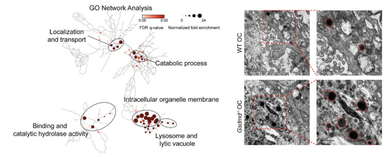基础医学院王迪课题组《Developmental Cell》揭示GSDMD在组织稳态中生理功能并报道其新切割片段抑制溶酶体成熟的生物学功能