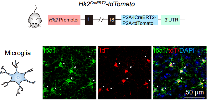 ZJU scientists discover the key roles of hexokinase 2 in shaping ...