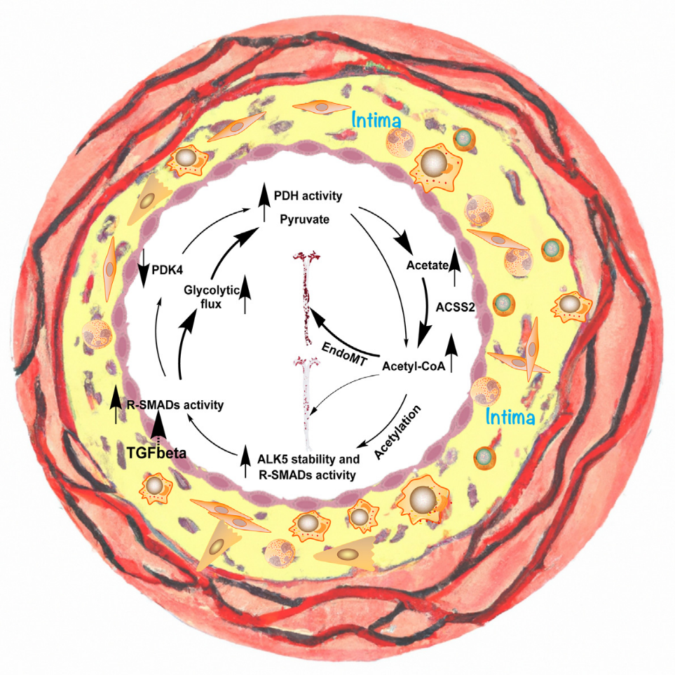 生命科学学院余路阳团队在Cell Metabolism合作发文阐明动脉粥样硬化中血管内皮的关键代谢调控机制