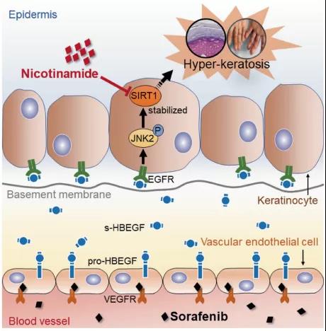 Nicotinamide shown to reverse sorafenib-induced HFSR