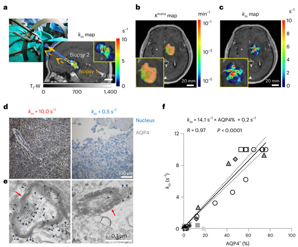 Scientists develop non-invasive technique for mapping AQP4 expression ...